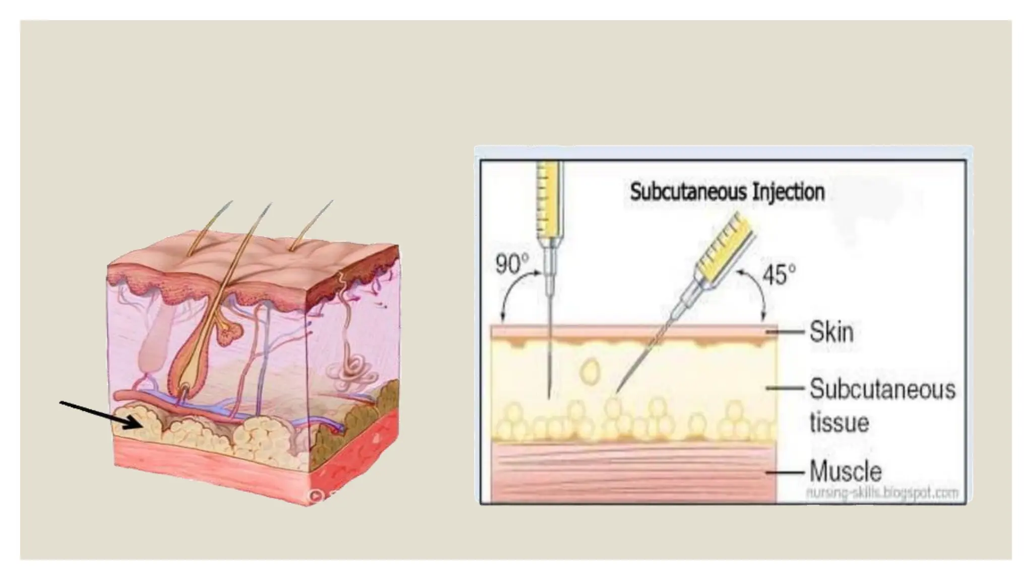 Presentation (1).pdf subcutaneous injection | PDF