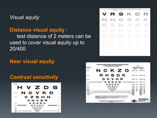 Low vision aids opthalmology by mior.pptx