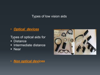 Low vision aids opthalmology by mior.pptx