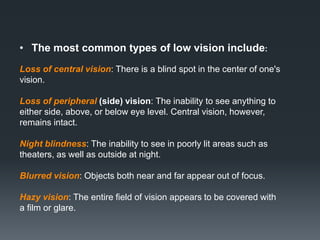 Low vision aids opthalmology by mior.pptx