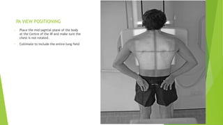 Presentation on the Xray of the shoulder, chest and pelvis | PPTX