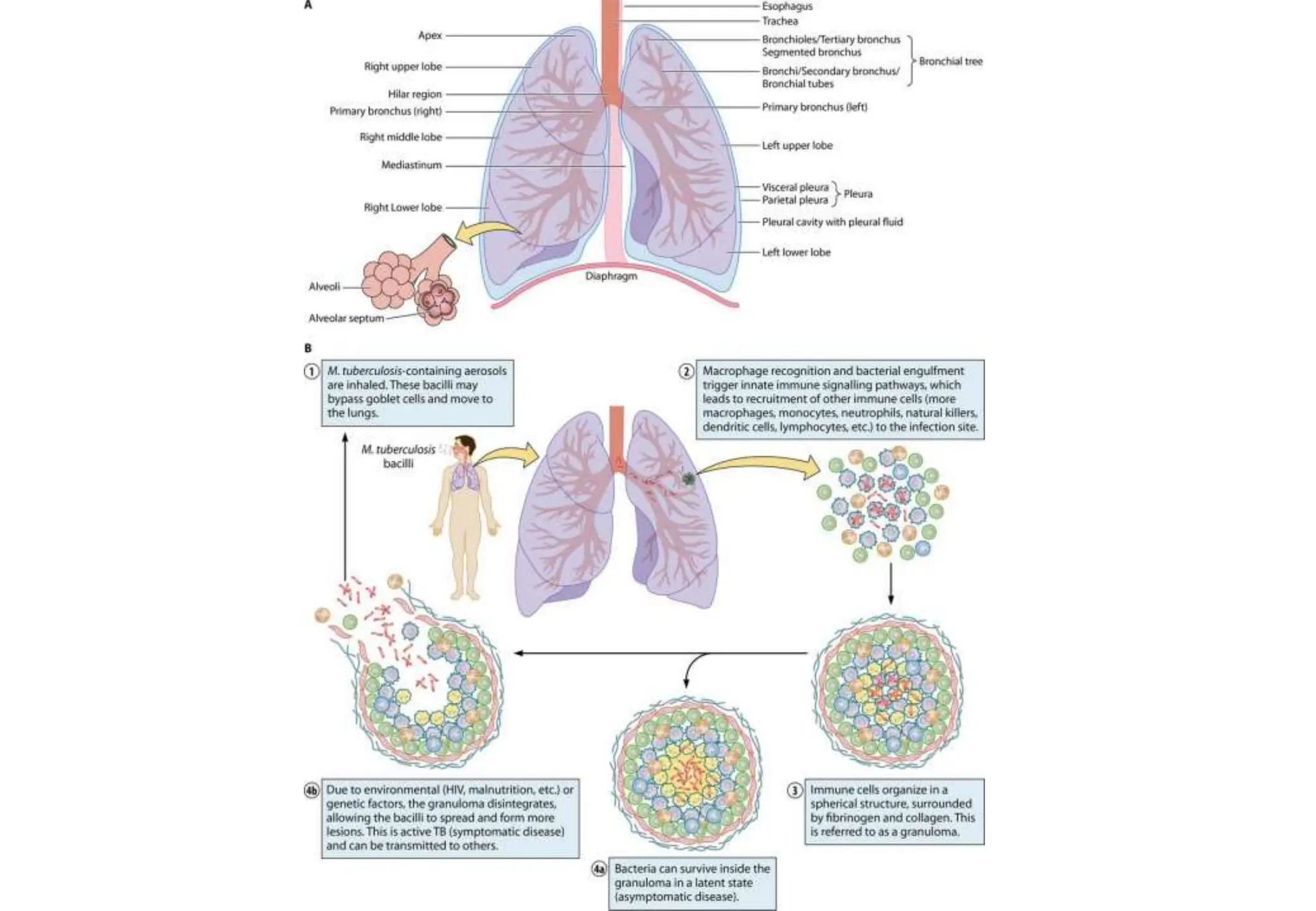 presentasi - tuberculosis tbc notes.pptx