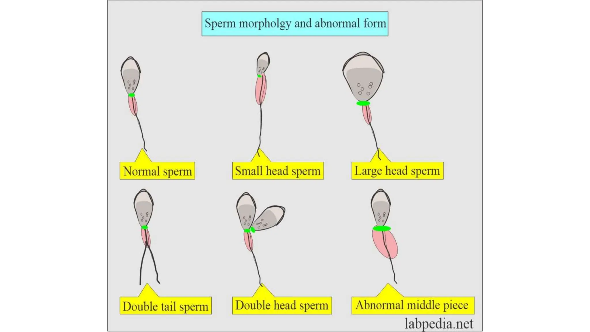 semen and seminal analysis in forensic science.pptx