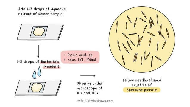 semen and seminal analysis in forensic science.pptx | Infertility ...