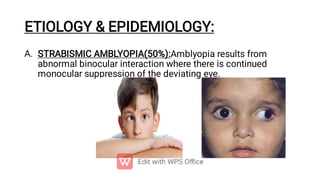 Presentation1.pdf...jejegbebkiih amblyopia | PPT