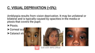 Presentation1.pdf...jejegbebkiih amblyopia | PDF