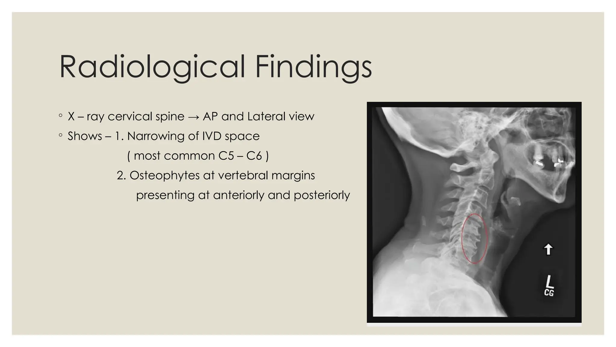 Cervical spondolysis slide imp hugg.pptx