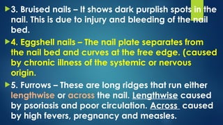 For Grades 8/9/10 and 11Nail Diseases and Disorders | PPT