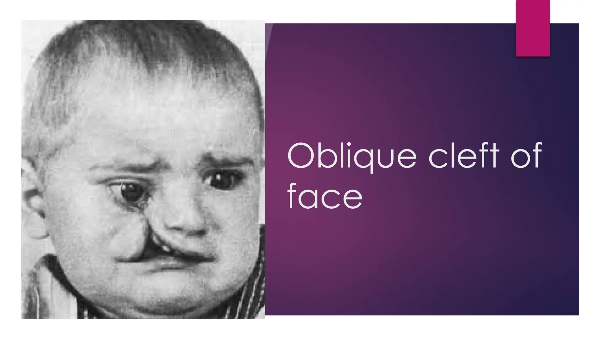 CLEFT LIP AND PALATE PLASTIC SURGERY PRESENTATION | PPTX