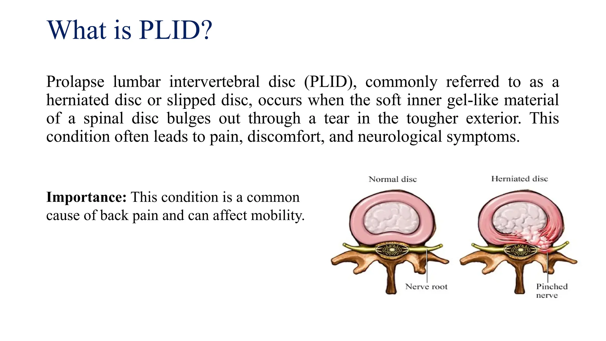 PLID: Understanding Causes, Symptoms, and Treatments | PPTX