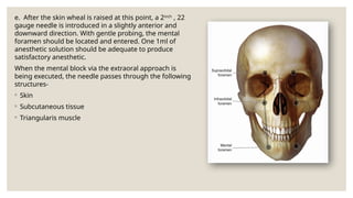 Local anesthetic- extraoral facial blocks | PPTX