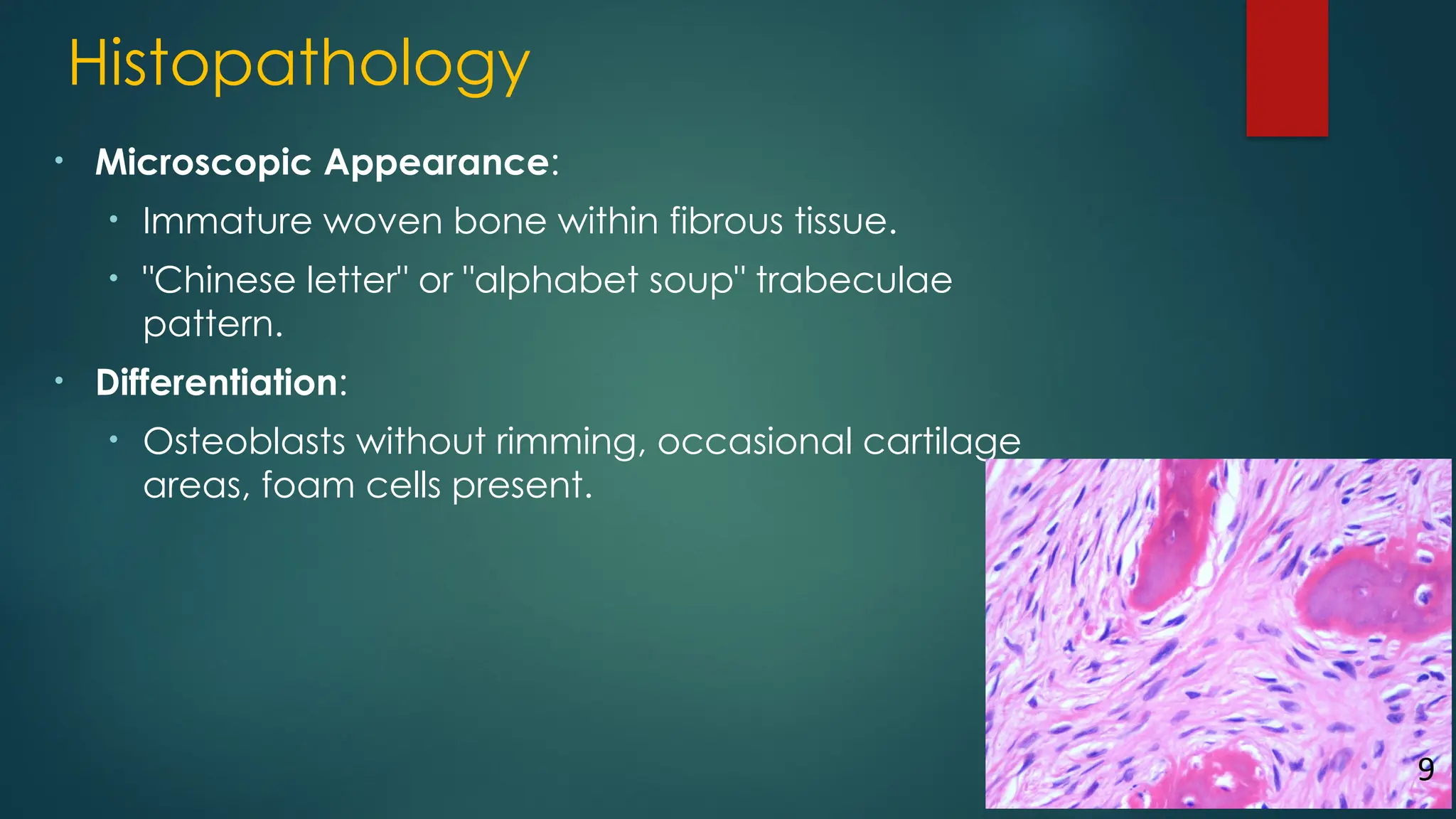 Bone tumors-fibrous dysplasia,simple bone cyst,aneurysmal bone cyst | PPT