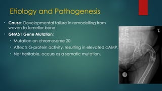 Bone tumors-fibrous dysplasia,simple bone cyst,aneurysmal bone cyst | PPT