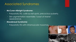 Bone tumors-fibrous dysplasia,simple bone cyst,aneurysmal bone cyst | PPTX