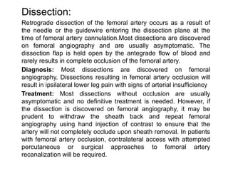 Femoral artery catheterisation and complications | PPTX