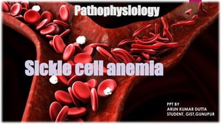 sickle cell anemia ppt by arun kumar dutta.pptx