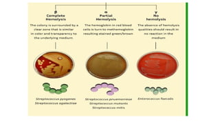 Microbiology common agars for testing in microbiology | PPTX