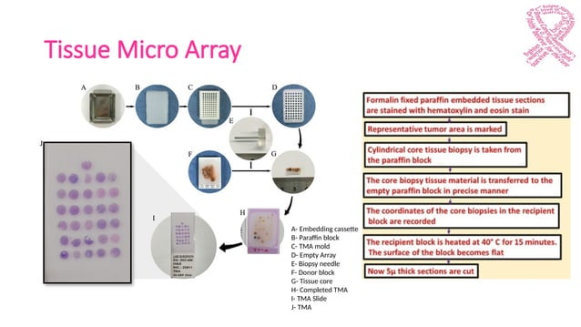 Presentation on breast cancer IHC markers | PPT
