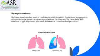 Anatomical Prefixes - hydro and hyster | PPTX