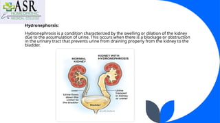 Anatomical Prefixes - hydro and hyster | PPTX