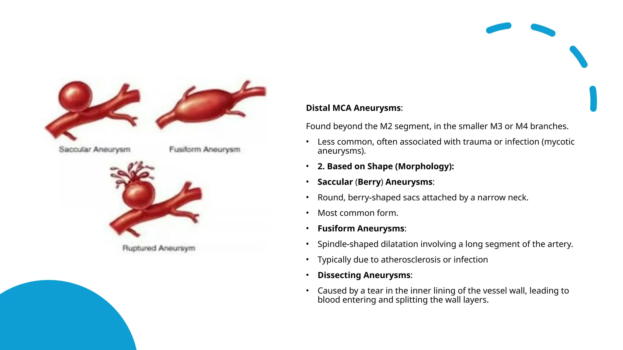 Medial cerebral artery anureysm presentation | PPTX
