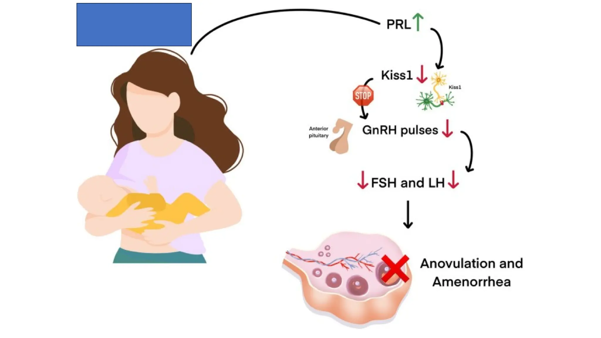 Presentation about lactation amenorrhea method | PPTX