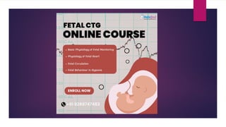 FETAL CTG MONITORING USG TRAINING FOR DOCTORS | PPTX