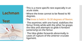 Presentation 1.pptx knee injuries with anatomy | PPTX