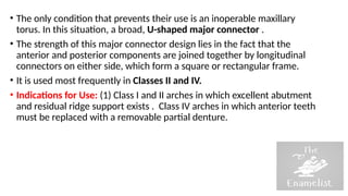 Maxillary major connector (removable partial denture ) | PPTX