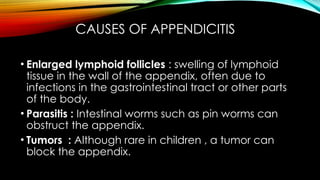 Presentation appendicitis - Arsala.pptm.pptx