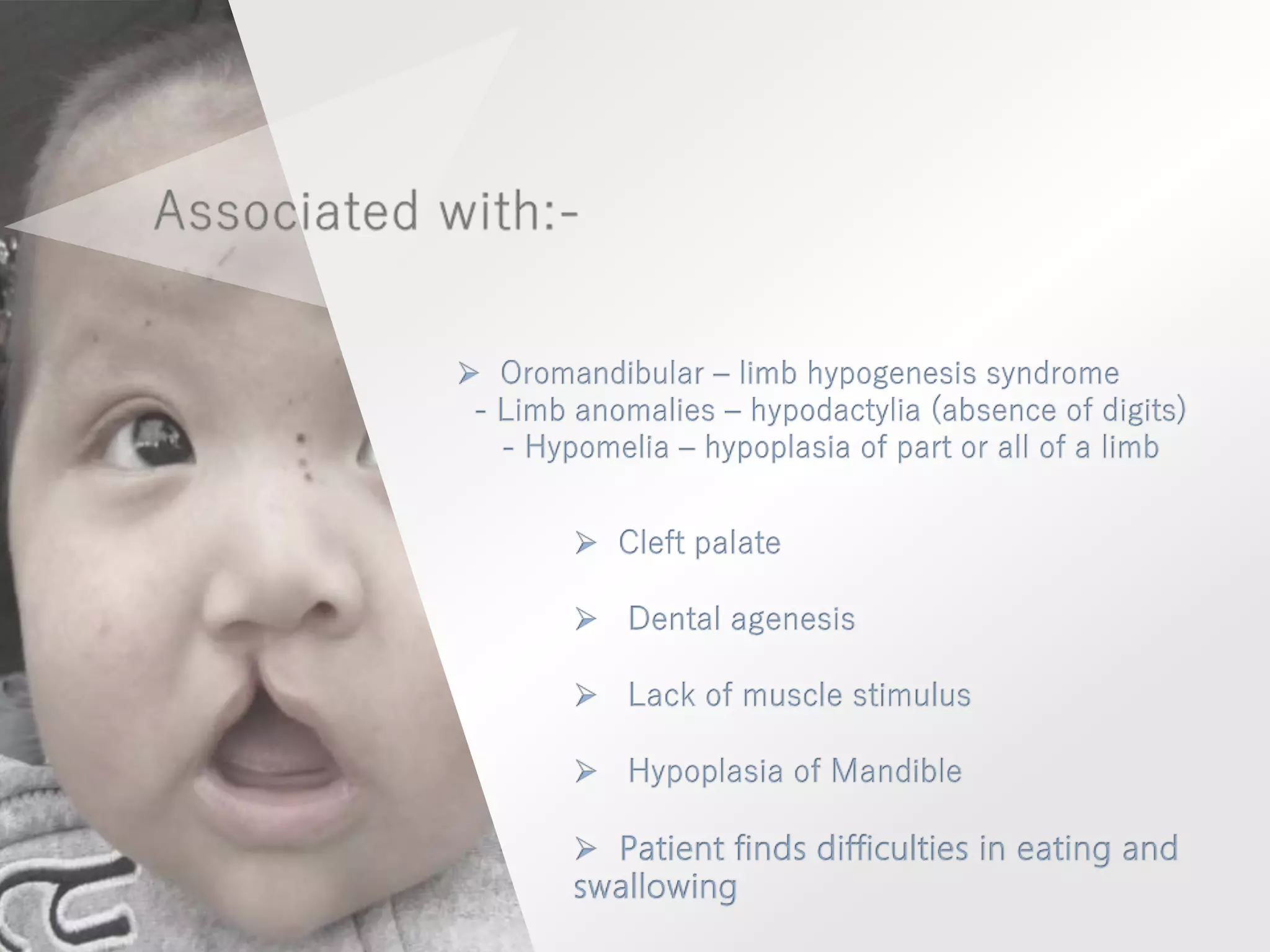 Developmental Disorders of The Tongue | PPTX
