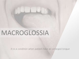 Developmental Disorders of The Tongue | PPTX