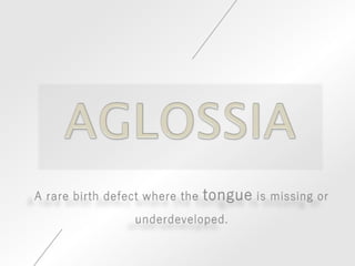 Developmental Disorders of The Tongue | PPTX
