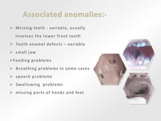 Developmental Disorders of The Tongue | PPTX