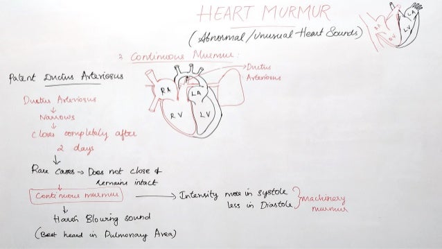 Important points about Heart sounds and Heart murmur | PDF