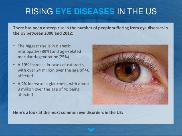 Common Eye Disorders