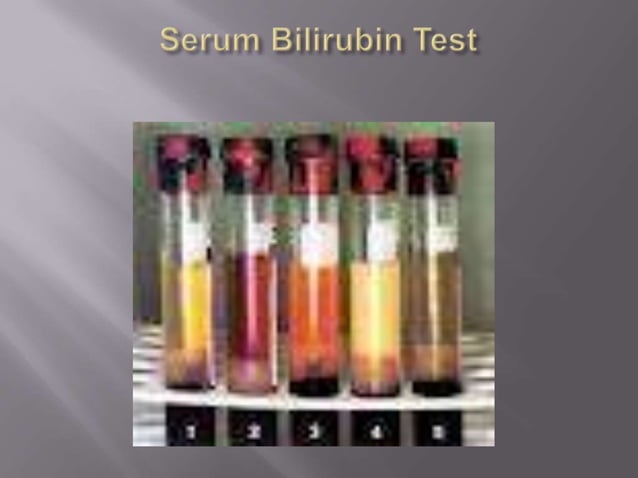 Presentation1.pptx chapter 8 | PPT