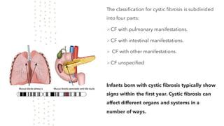 Cystic Fibrosis. GIT Manifestations. Diagnosis. Treatment | PPT