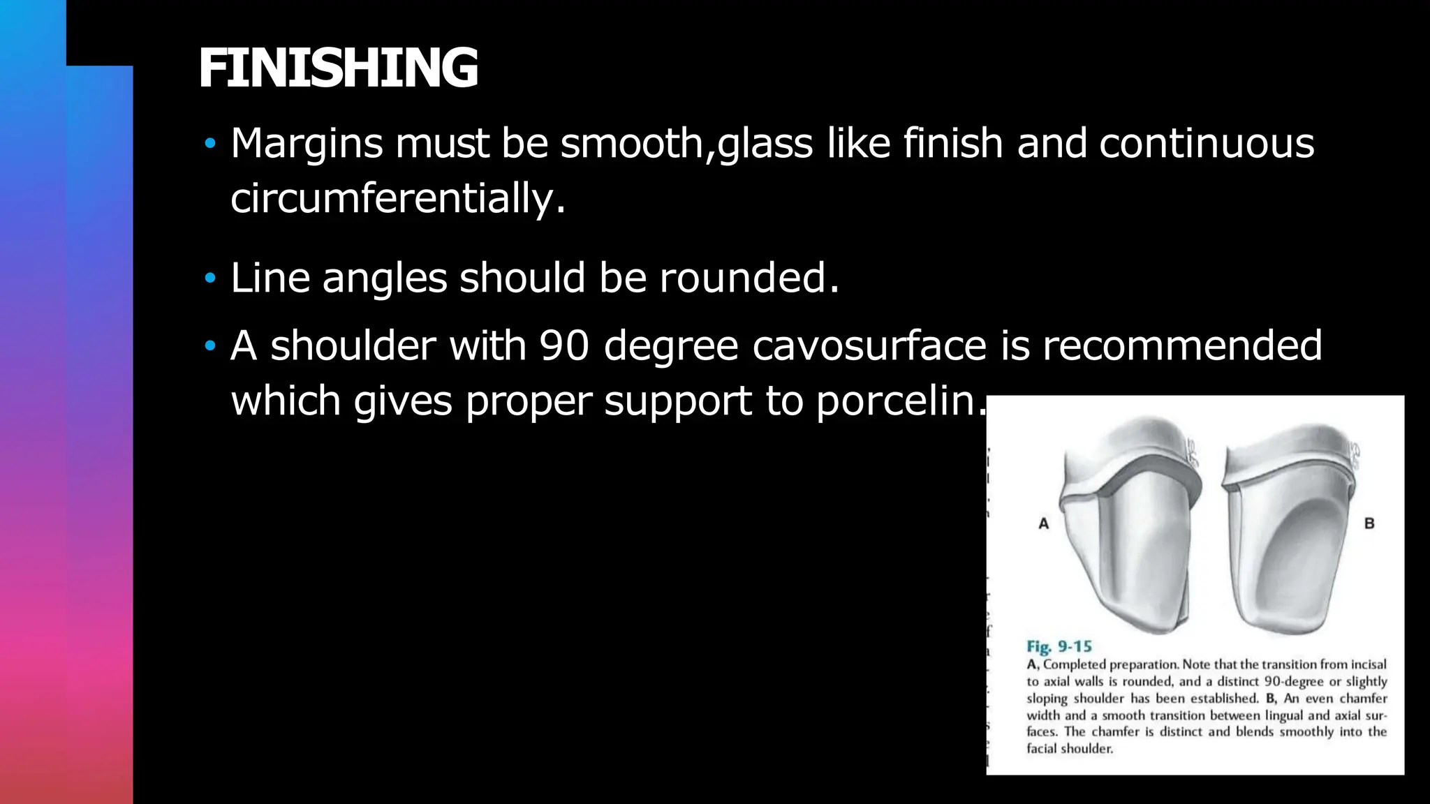Presentation 10.pptx the metal ceramic crown preparation | PPTX