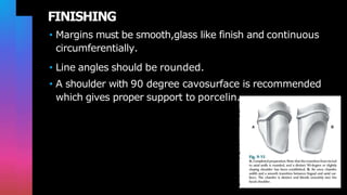 Presentation 10.pptx the metal ceramic crown preparation | PPTX