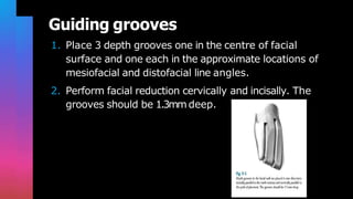 Presentation 10.pptx the metal ceramic crown preparation | PPTX