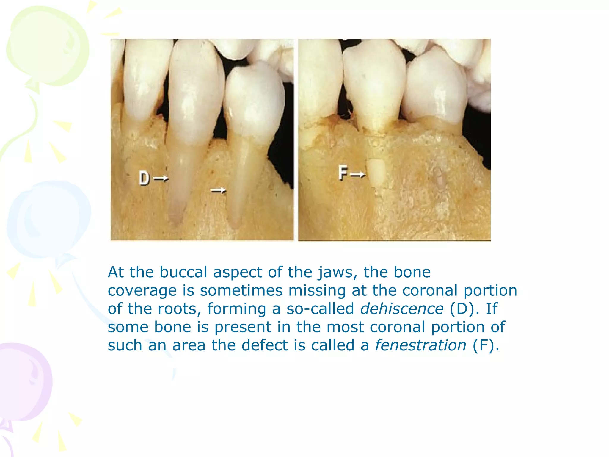 Periodontology Alveolar bone By Hassan Ayyad | PPT