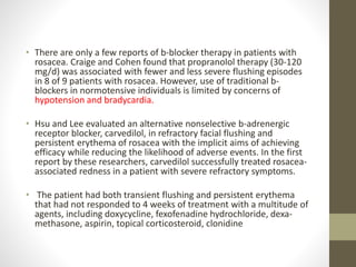 Rocasea - Dr Hasan Khalaf | PPTX