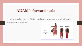 presentation on spinal defects and deformities | PDF