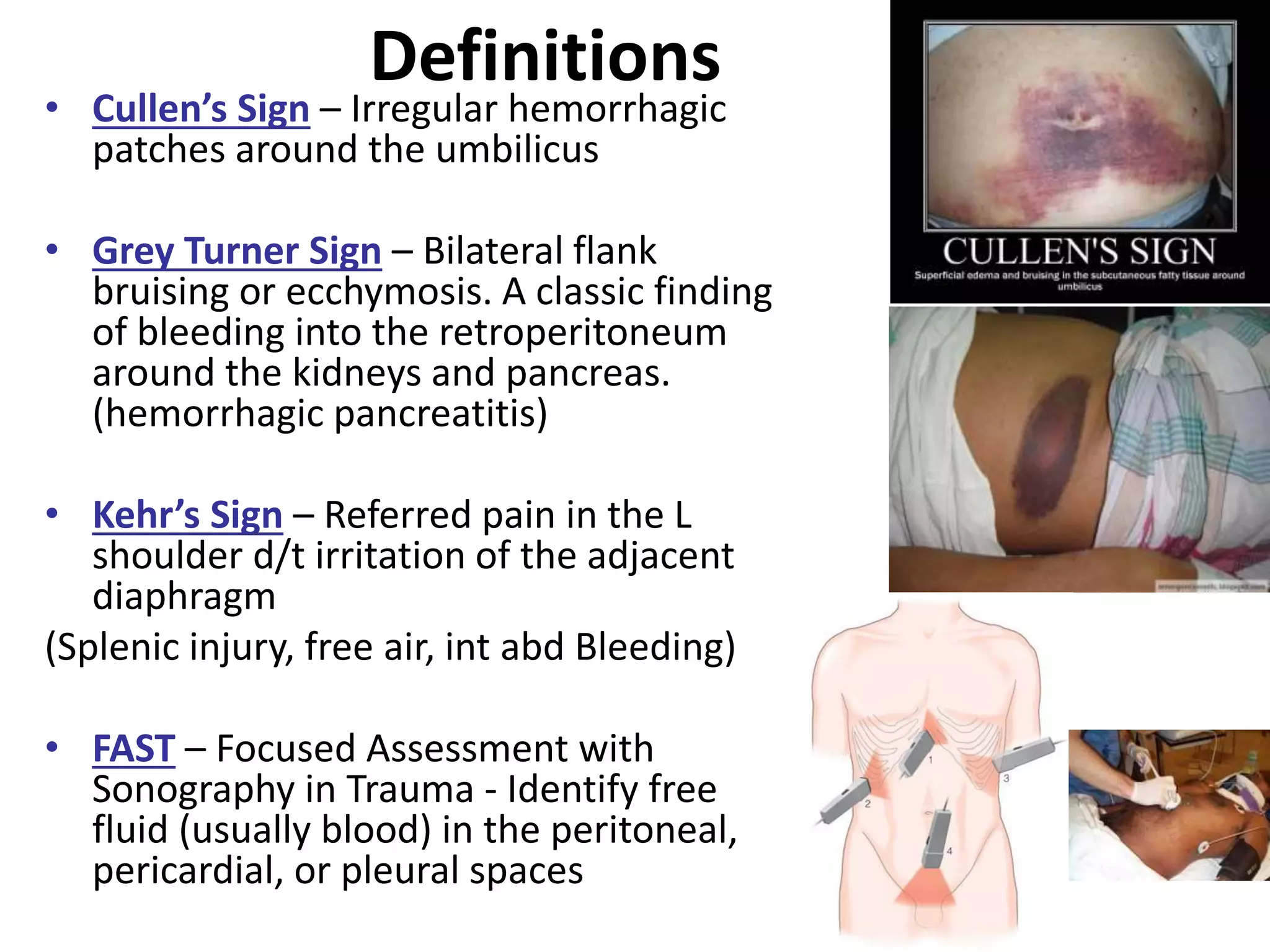 Abdominal-injuries-in-sports.pptx