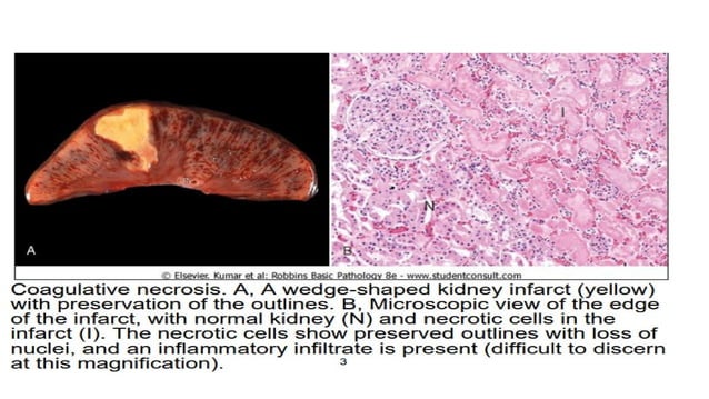 necrosis and degeneration-cell degeneration | PPTX | Chemistry | Science
