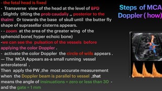 Presentation 11MCA Doppler .pdf