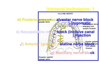 Anesthesia | PPT | Dental Health | Diseases and Conditions