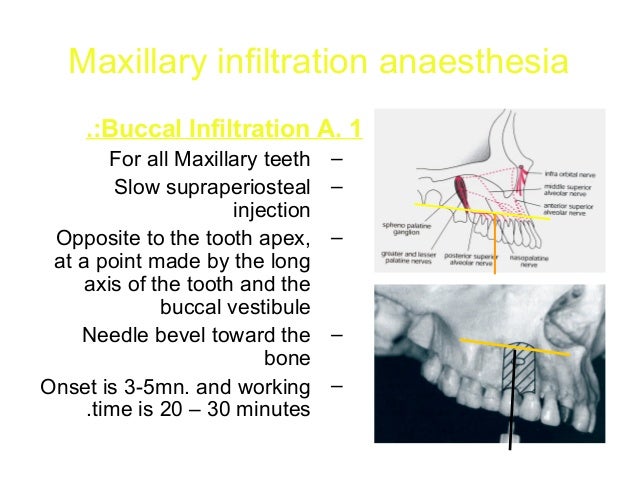 Anesthesia