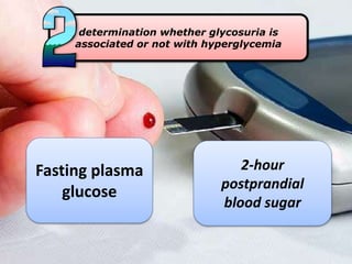 Investigations of glycosuria | PPTX